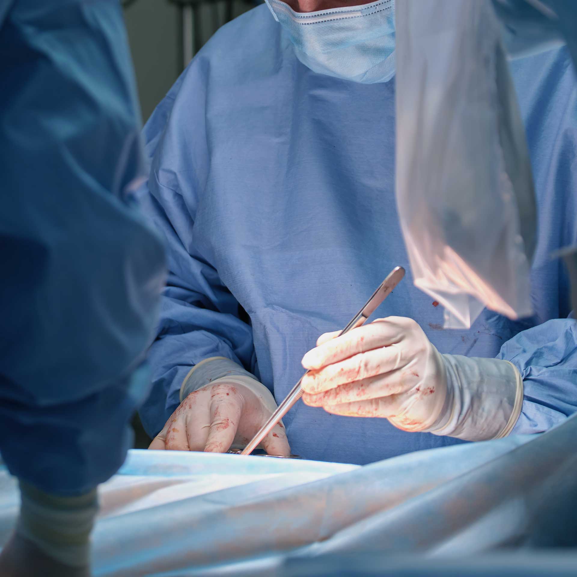 Gastric Sleeve – Go Surgery Tijuana
